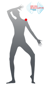 Frozen Shoulder | Devon Shockwave